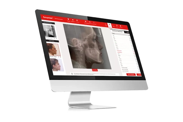 スマーティー（Smartee）「スマーティー矯正」サイト